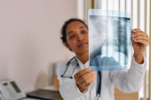 X-rays and scans: what are the differences?