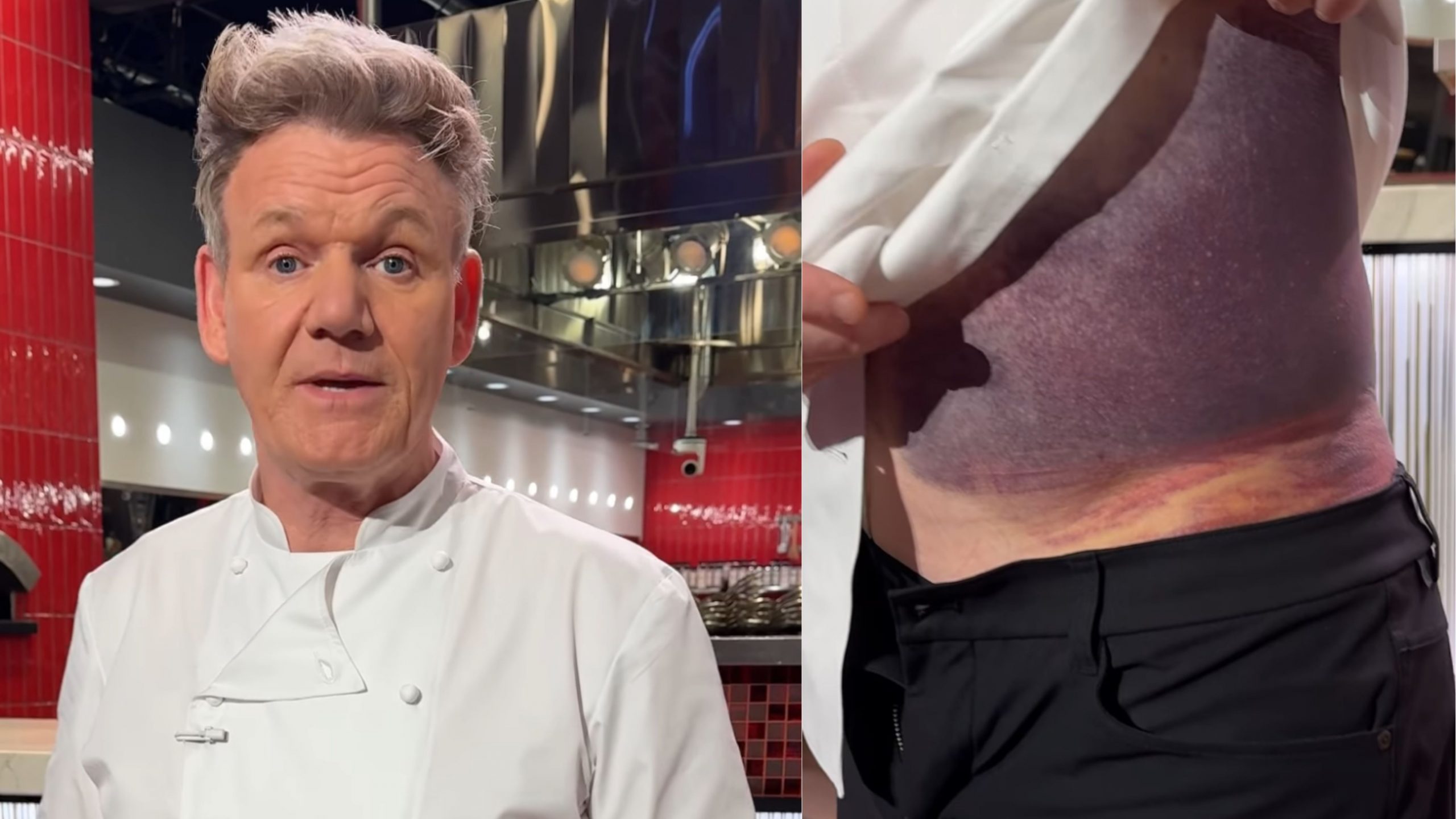 WATCH: Chef Gordon Ramsay 'lucky to be here' after cycling accident